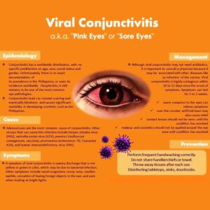 Eyes On The Prize: Overcoming Eye Flu With Expert Tips