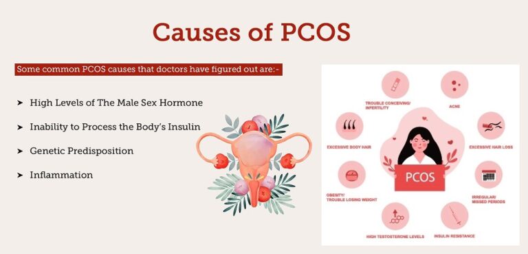 Empowering Women: A Comprehensive Guide To PCOS
